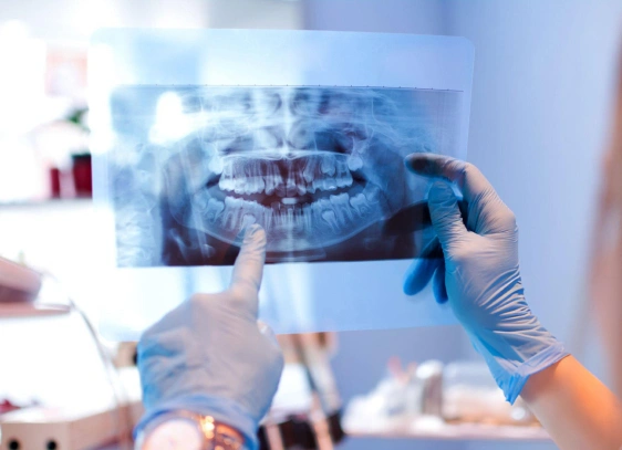 Dental X-rays Brimfield OH | Dennis Dental Care